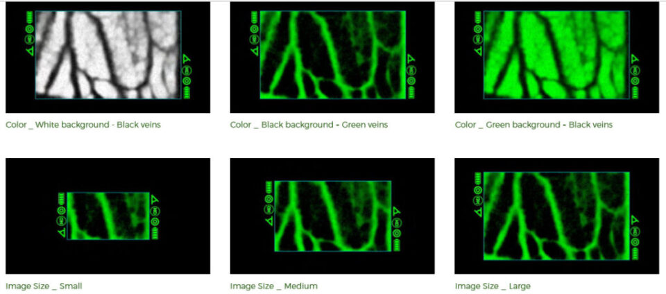 Infrared Vein Viewer: SIFVEIN-1.0 - SIFSOF