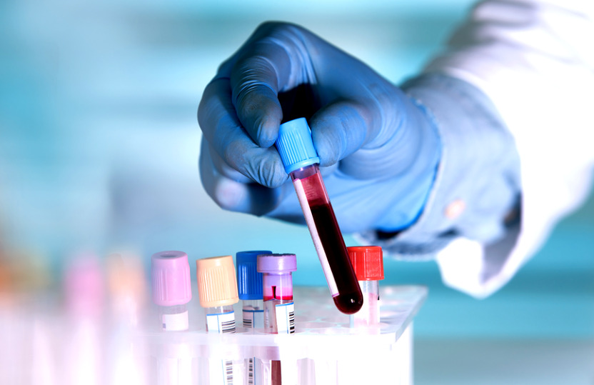 Vein Finder Assisting in Blood Collection For Lab Study - SIFSOF