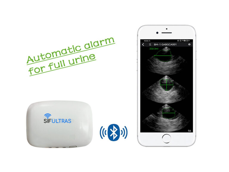 Wearable Real-time Urine Volume Monitor